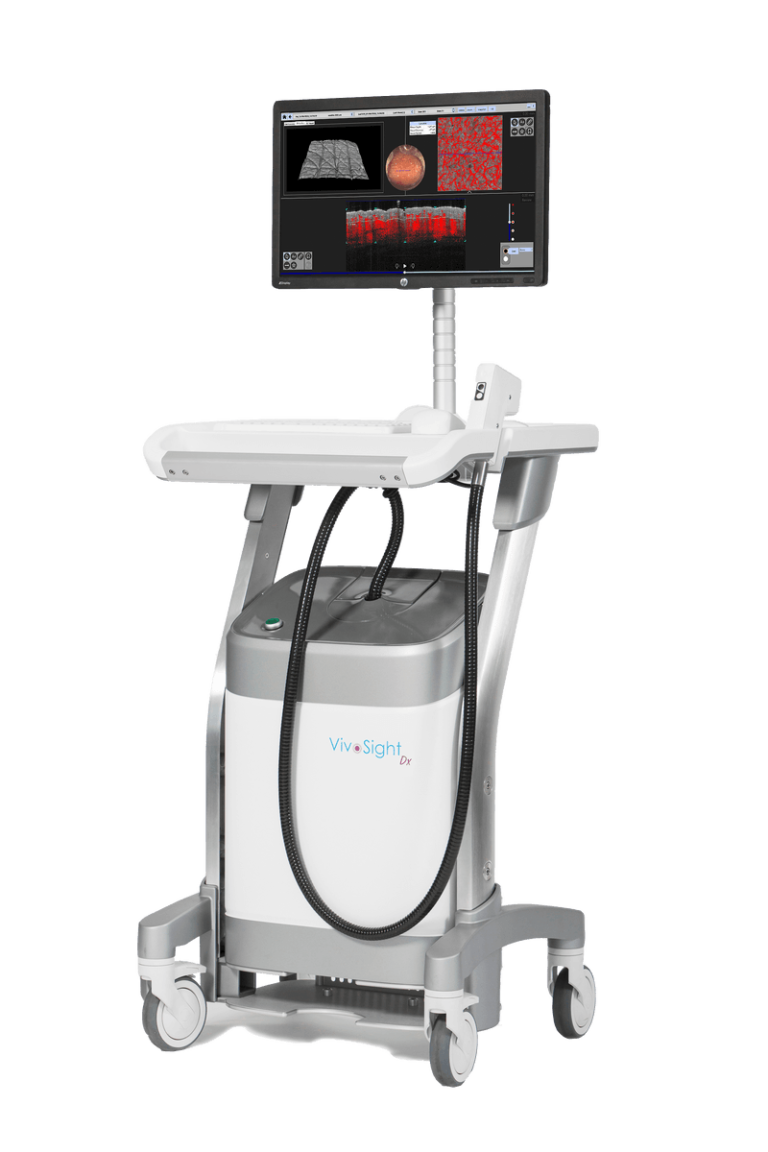 Measuring Skin with VivoSight OCT – VivoSight