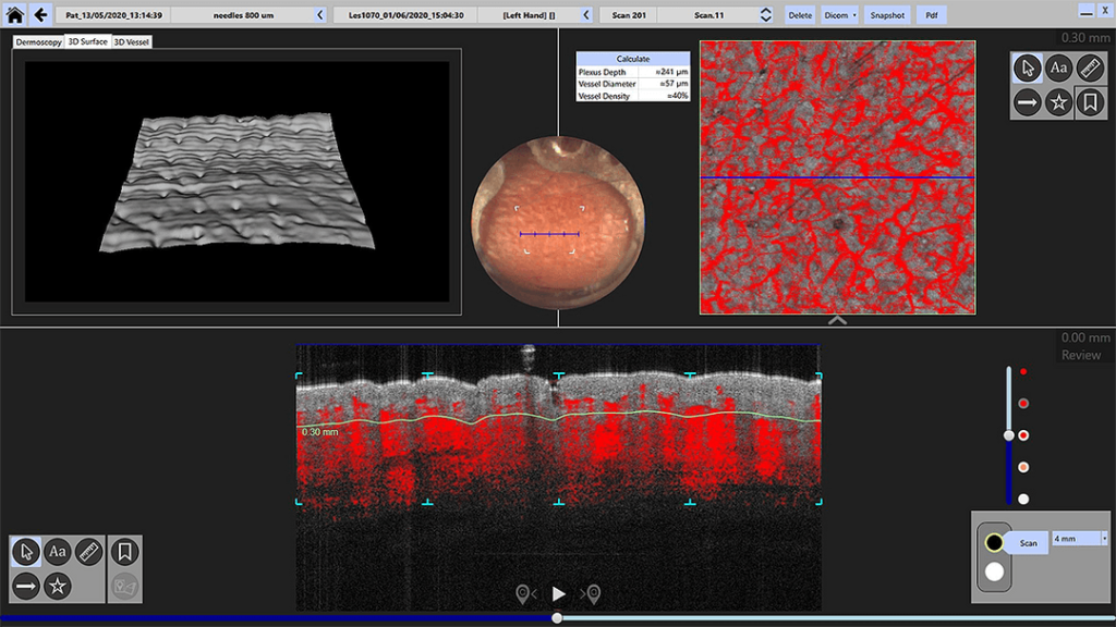 VivoSight Dx – VivoSight