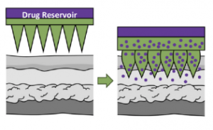 Microneedles & Transdermal Applications – VivoSight