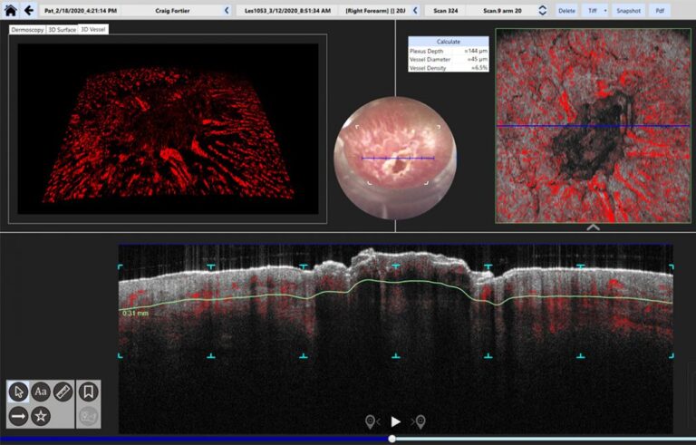 Companion Products – VivoSight