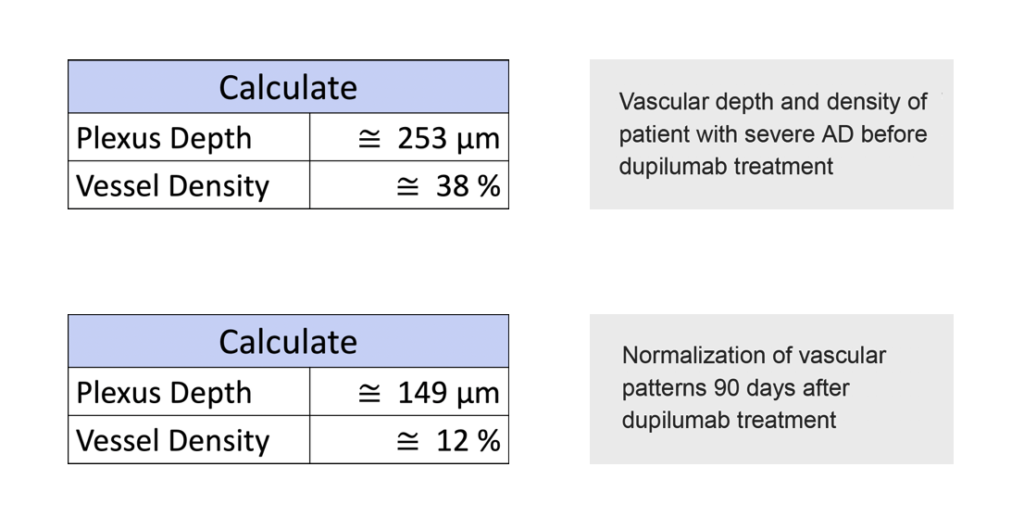 Atopic Dermatitis & Contact Dermatitis – VivoSight